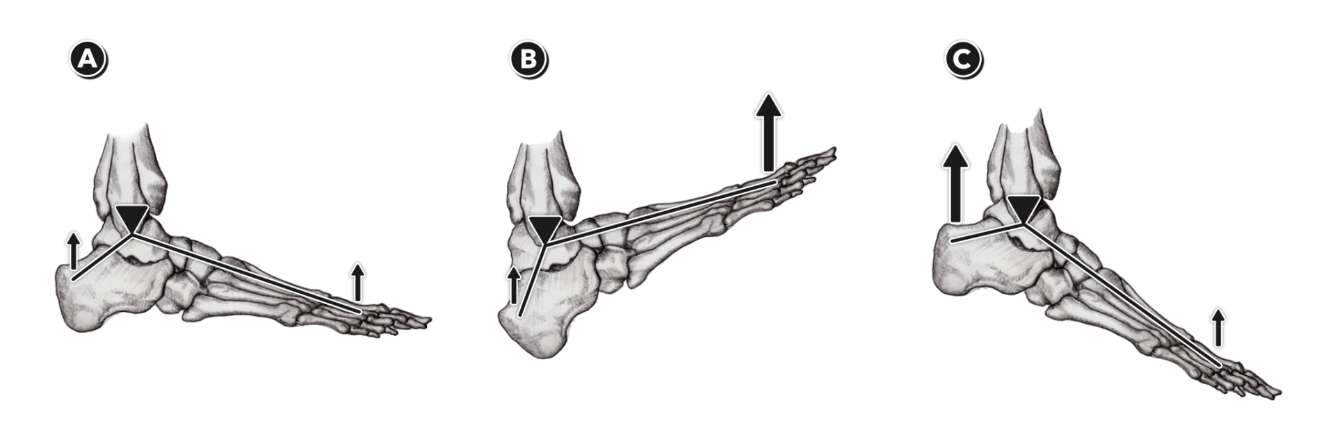 CrossFit | Anatomy of Levers, Part 1: First-Class Levers