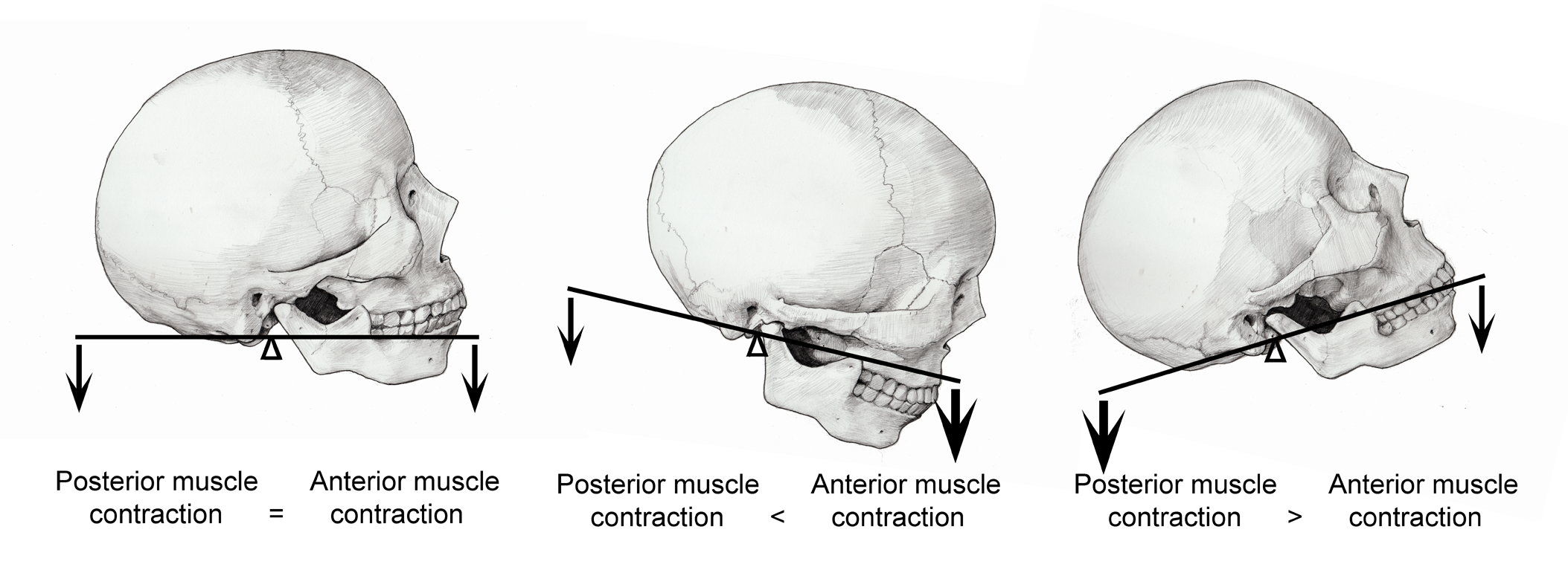 CrossFit | Levers Article 1
