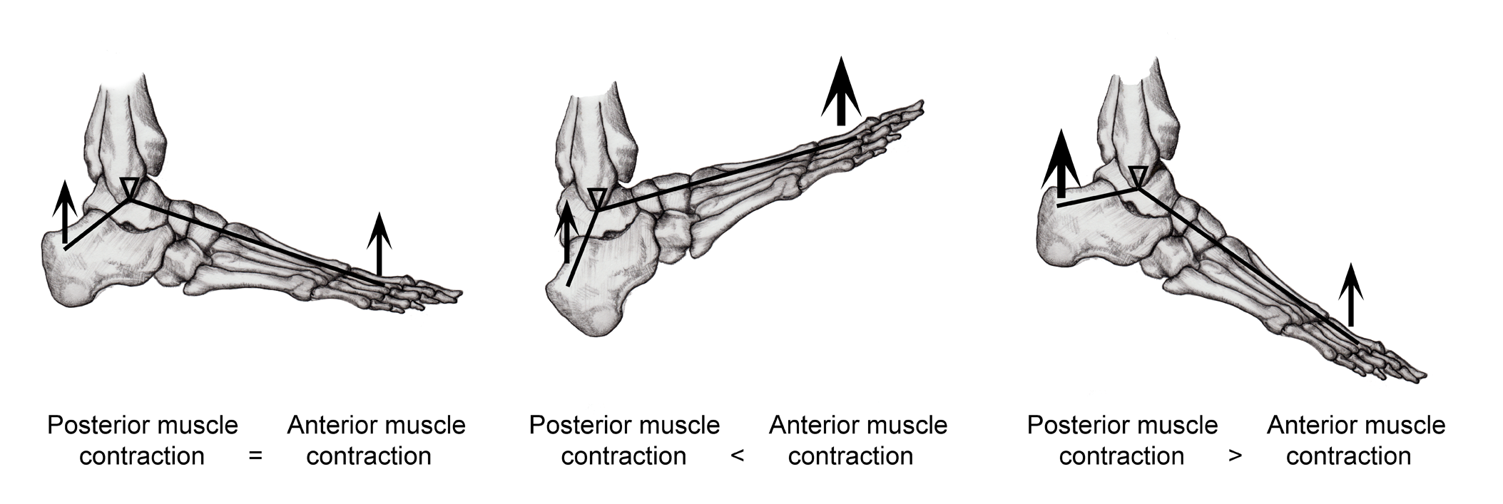 CrossFit | Levers Article 1