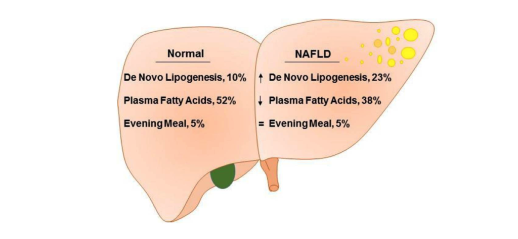 CrossFit | Role of Dietary Fructose and Hepatic De Novo Lipogenesis In ...