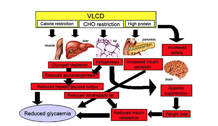CrossFit | Effects and Clinical Potential of Very-Low-Calorie Diets ...