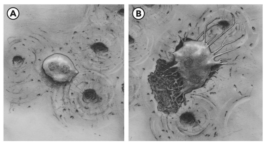 CrossFit | Bone Deposition and Osteoporosis