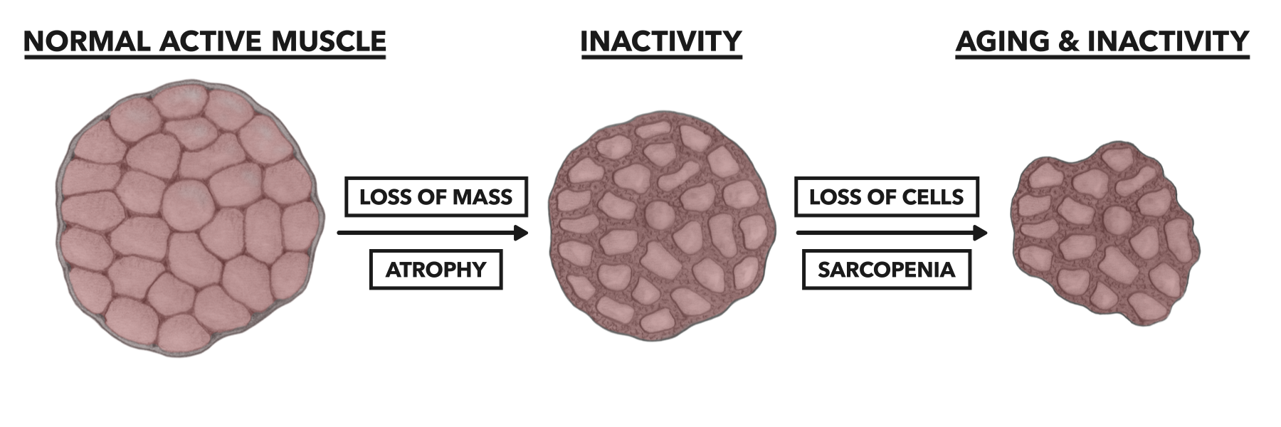 CrossFit | Muscle Basics, Part 4: Atrophy & Sarcopenia