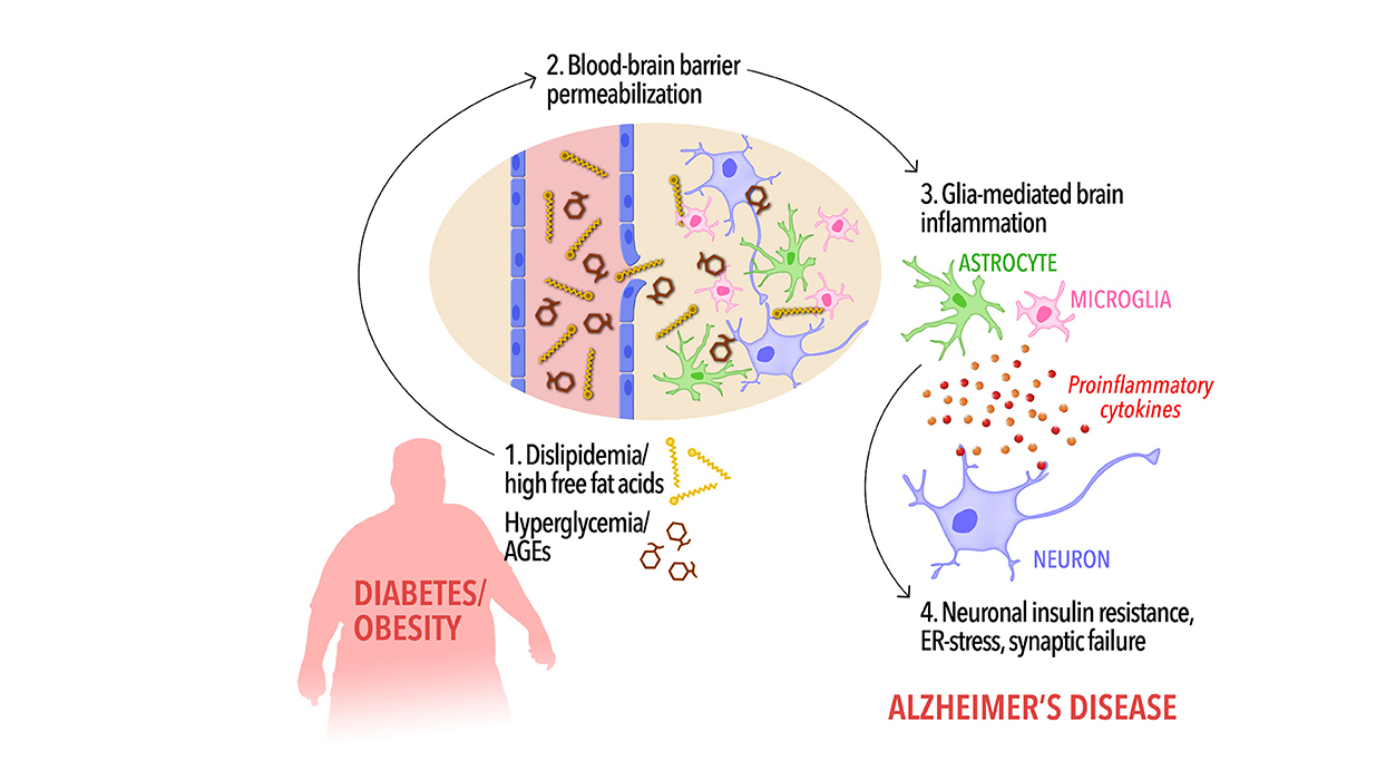 CrossFit | Insulin Resistance in Alzheimer's Disease
