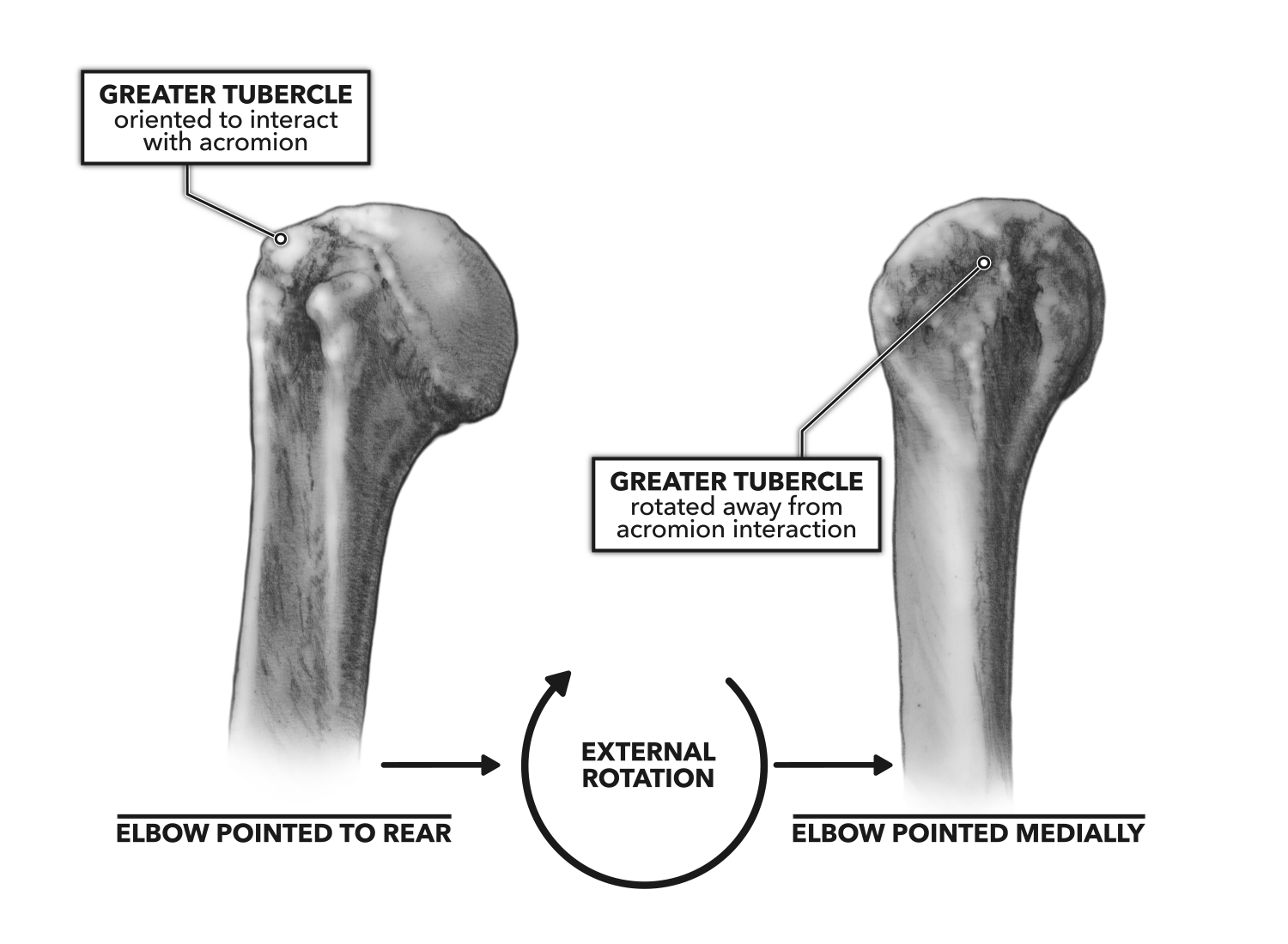 CrossFit | Shoulder Musculature, Part 4: Impingement