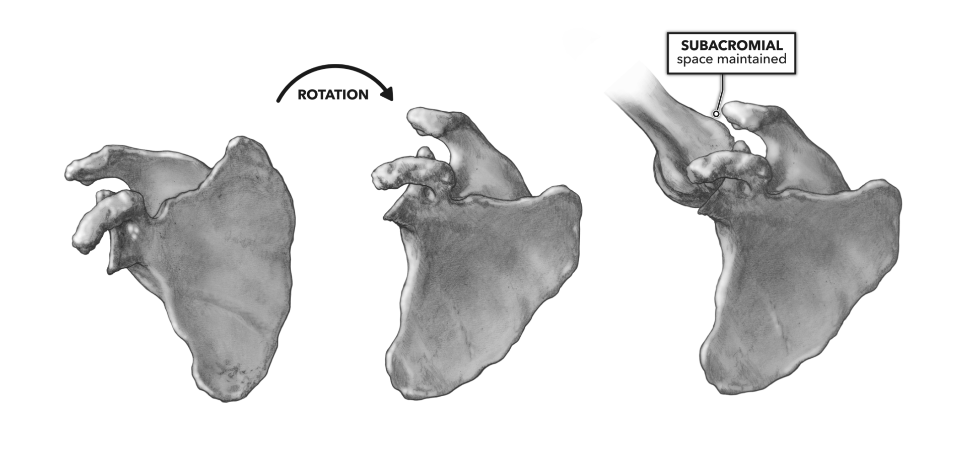 CrossFit | Shoulder Musculature, Part 4: Impingement