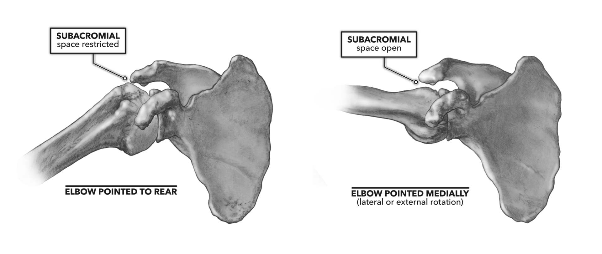 CrossFit | Shoulder Musculature, Part 4: Impingement